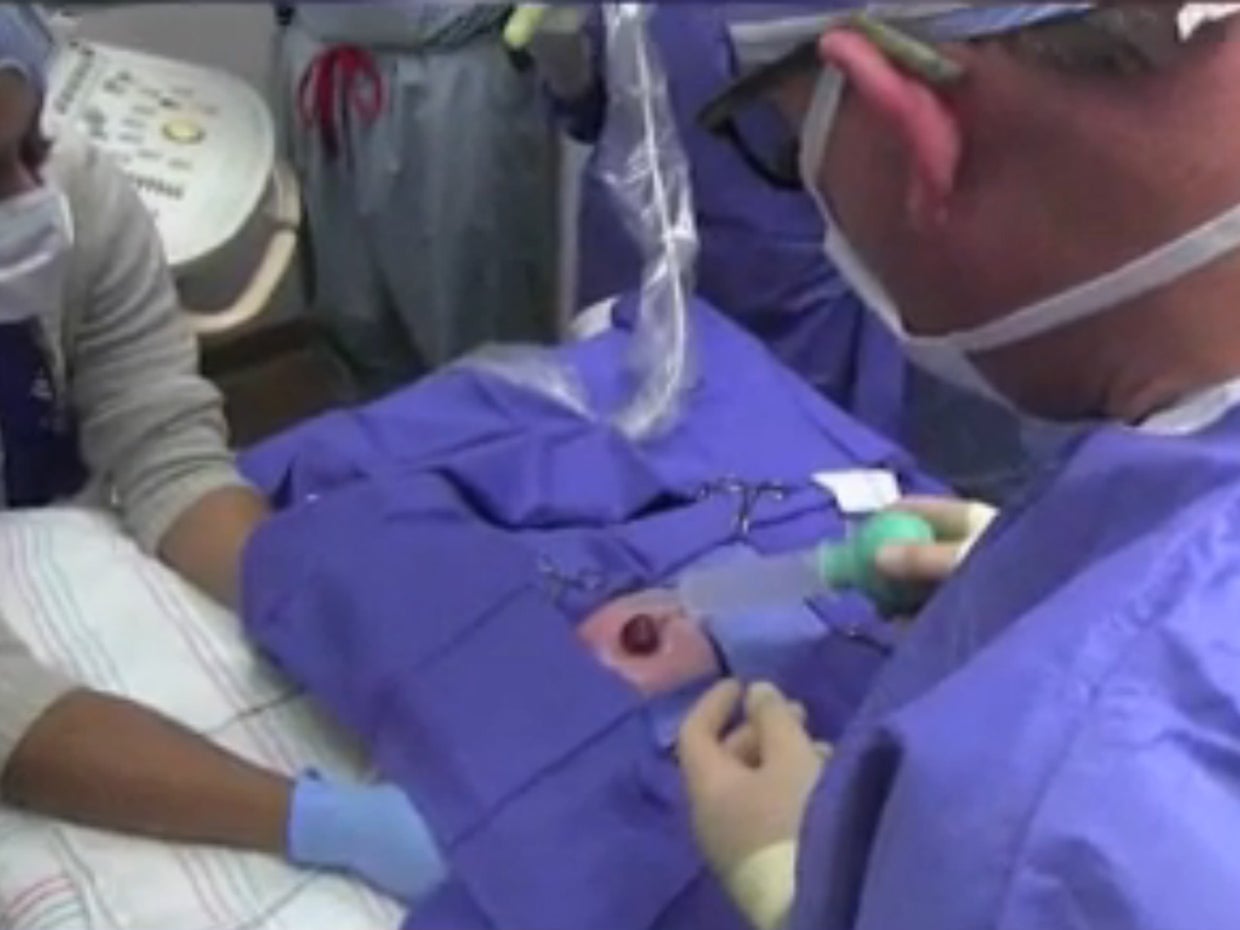 Baby born with heart outside body