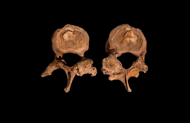 richard the third skeleton