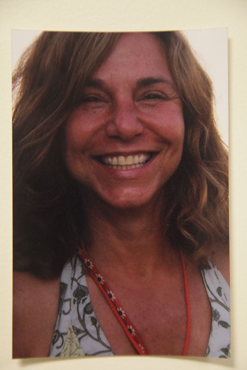 Amazing face transplants (GRAPHIC IMAGES)