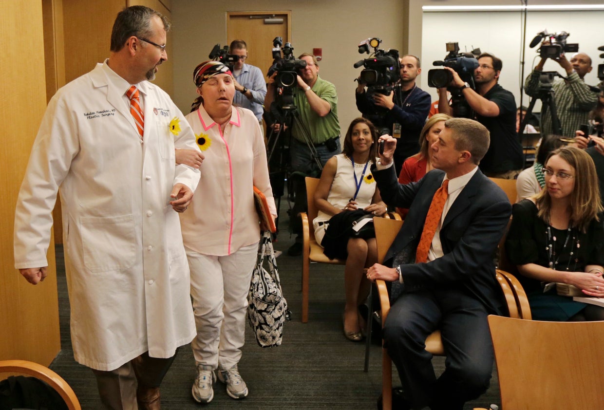 Amazing face transplants (GRAPHIC IMAGES)