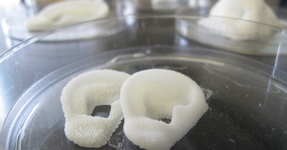 Scientists grow new organs on scaffolding