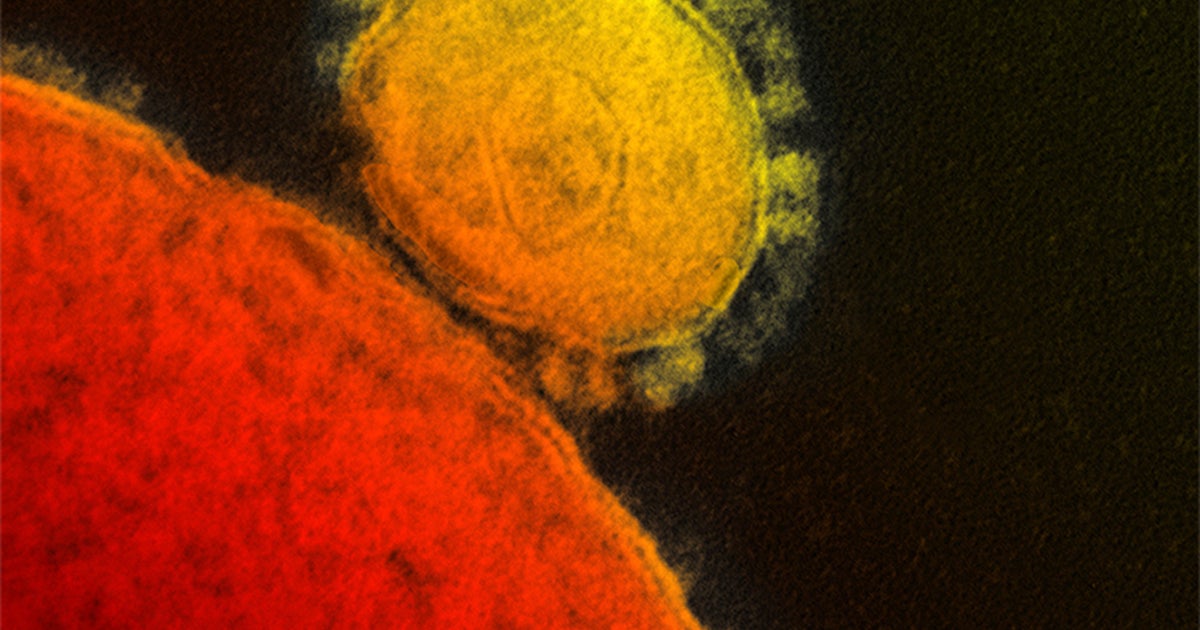 MERS case reported in Spain, Ministry confirms - CBS News
