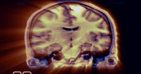 Advancements In Brain Imaging - CBS News