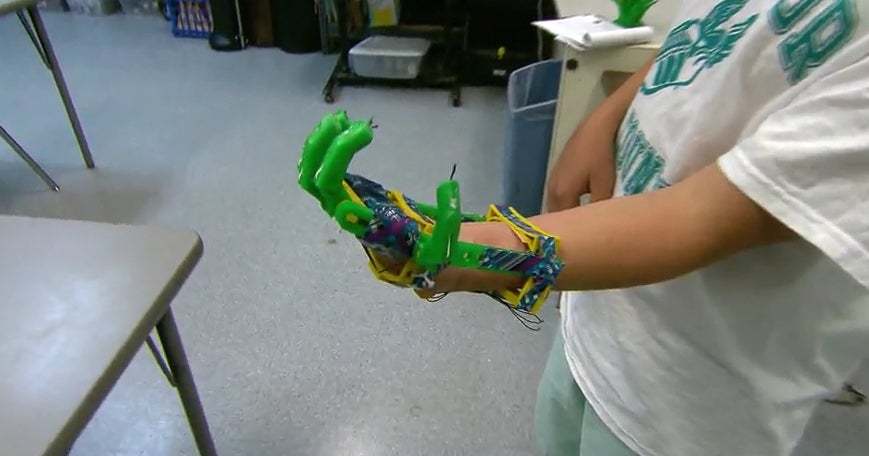 Boy gets prosthetic hand made by 3-D printer - CBS News
