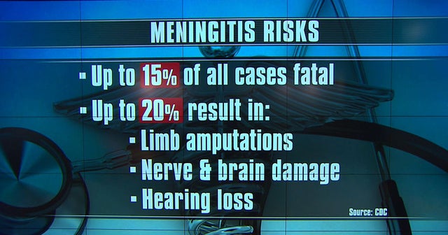 Meningitis outbreak pops up on two U.S. college campuses - CBS News