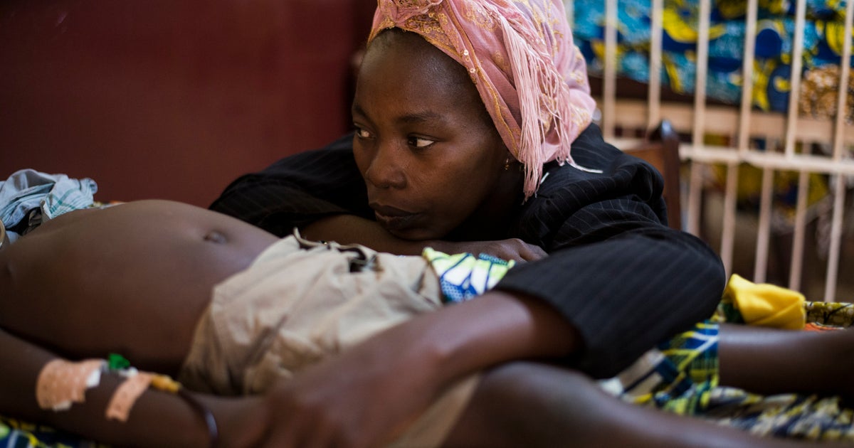 Malaria: A persistent global killer - CBS News