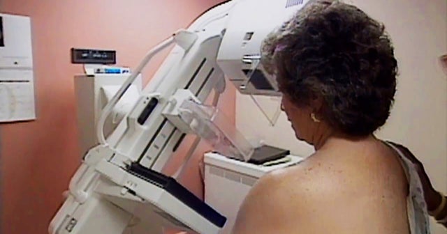 Do Mammograms Really Save Lives Cbs News