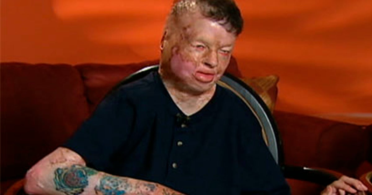 Robert Middleton Burning Case: Hearing set for Texas man accused of ...