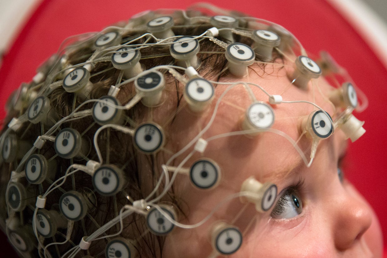 Unlocking secrets of babies' brains