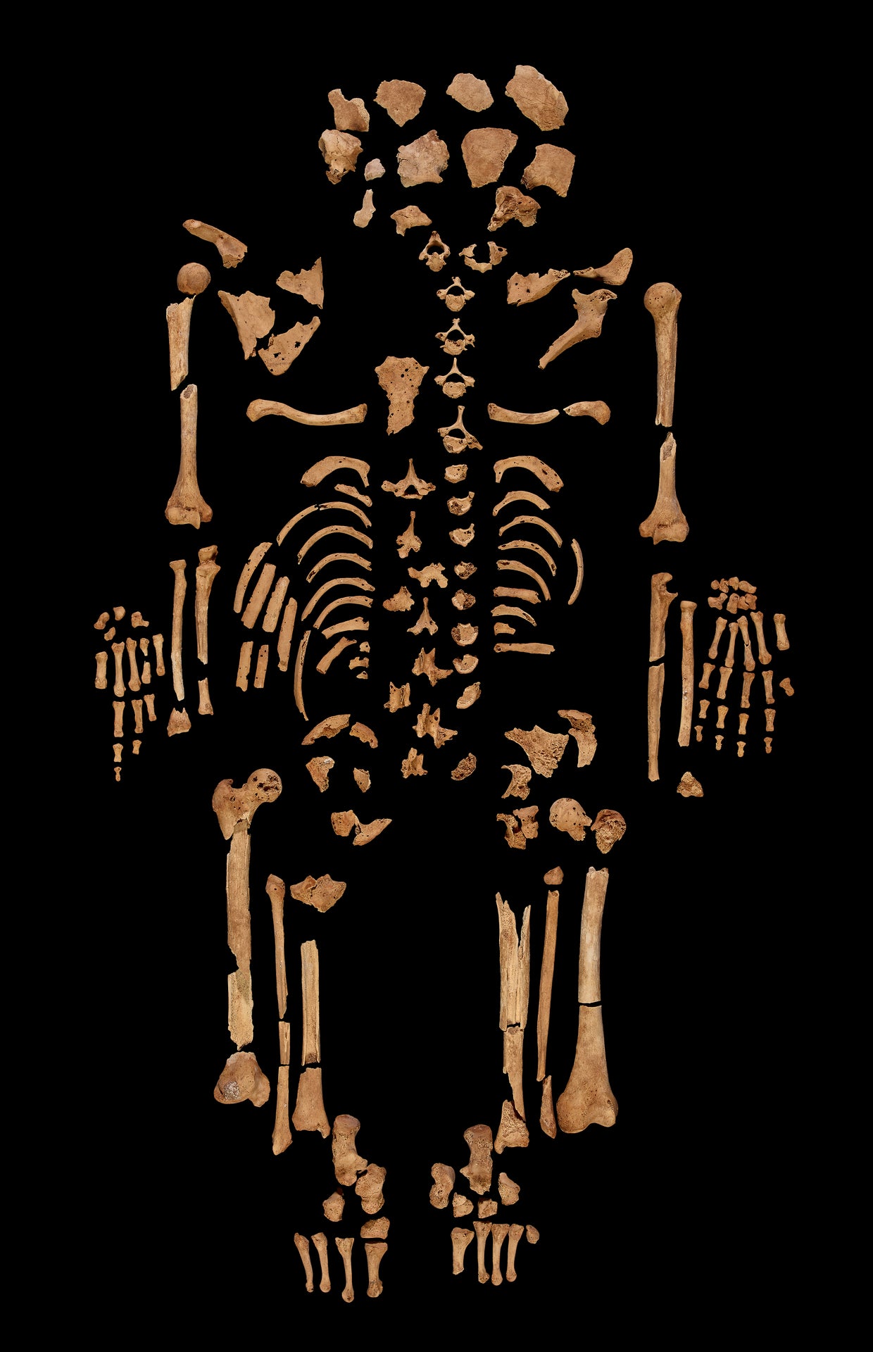 3,000-year-old skeleton riddled with cancer