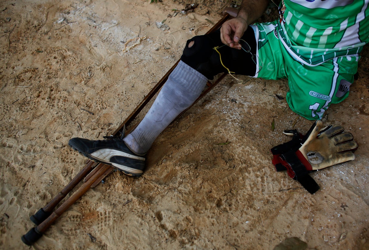 One-legged goalie