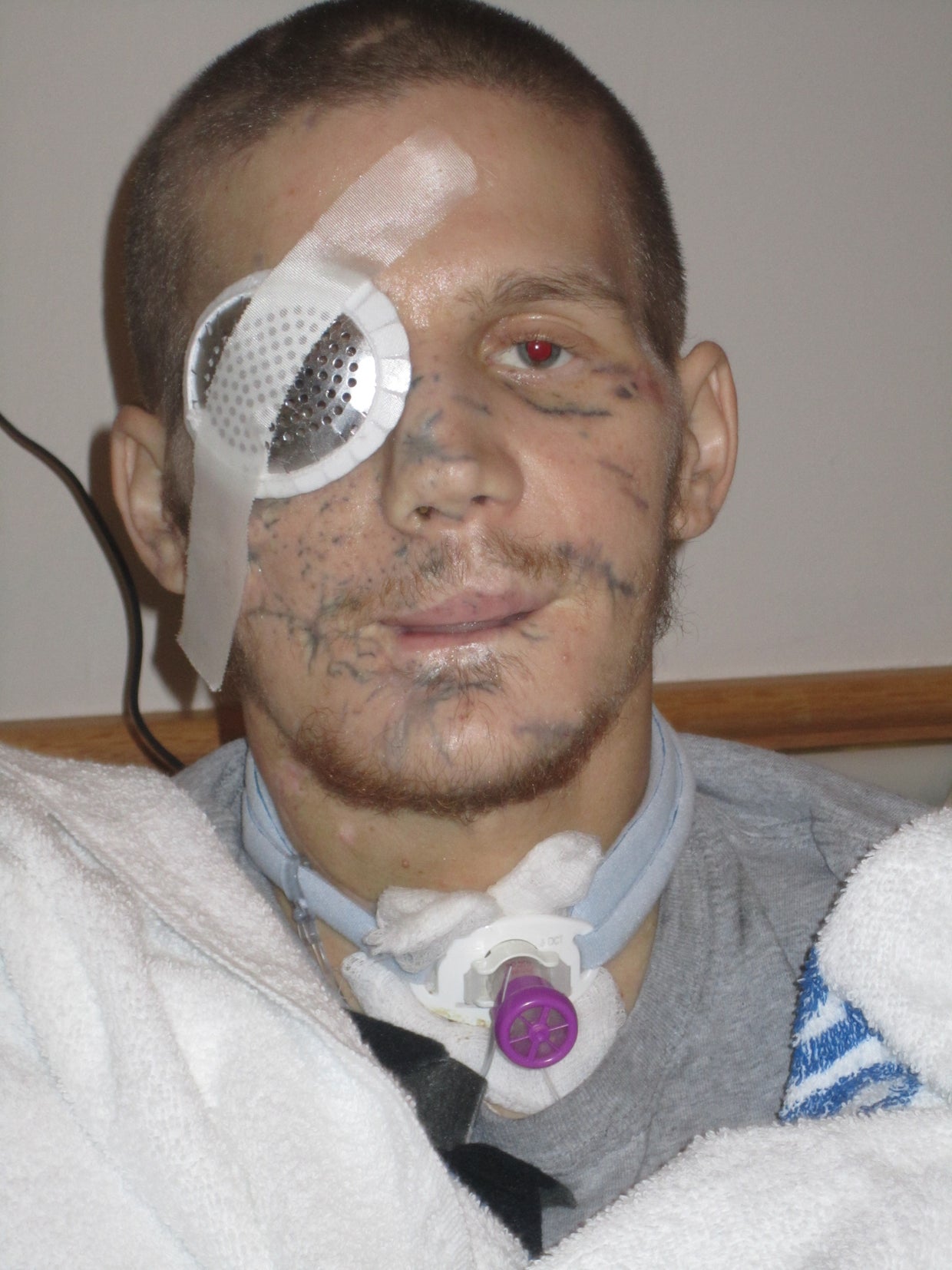 Kyle Carpenter, an American hero
