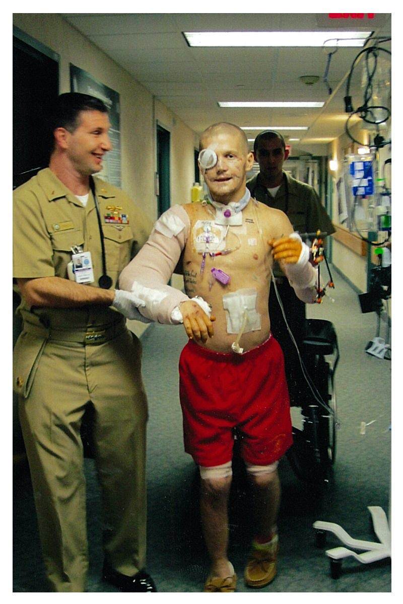 Kyle Carpenter, an American hero