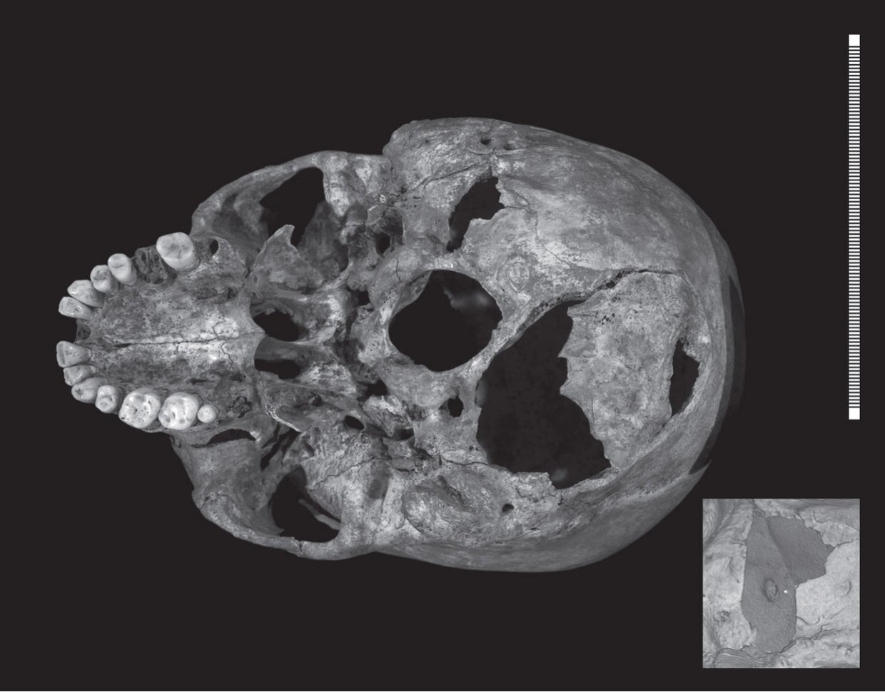 Forensic science solves mystery of Richard III's death - CBS News