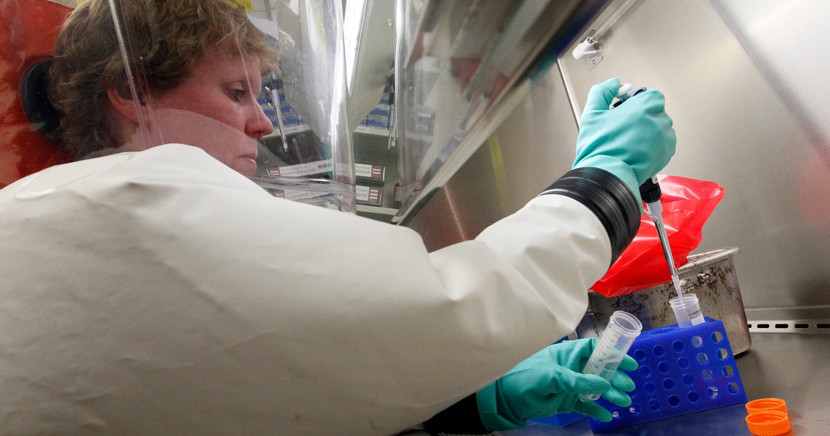 More studies needed on contagious Ebola virus and bodily fluids - CBS News
