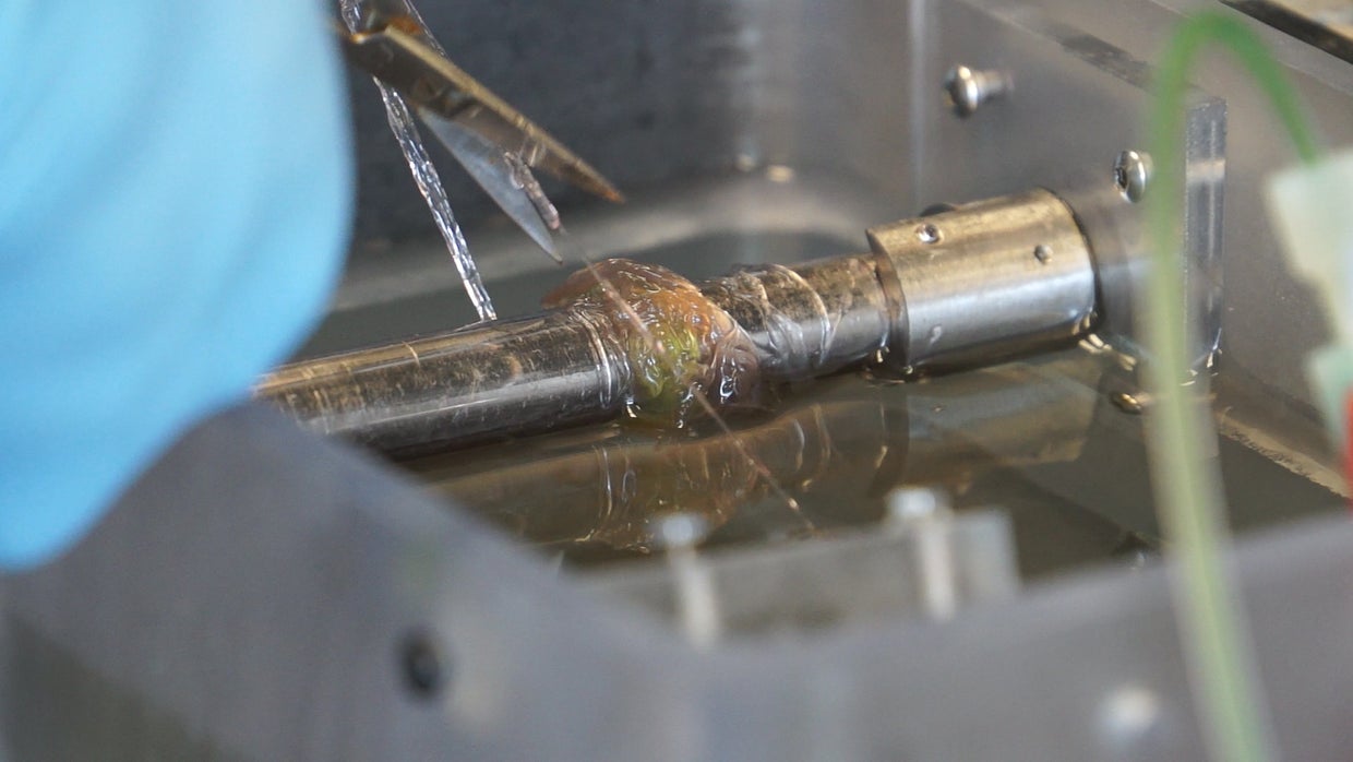 How 3D printing could revolutionize burn treatment - CBS News