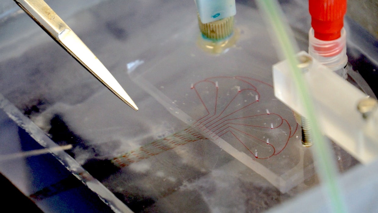 Photos: 3D printing and the future of burn treatment