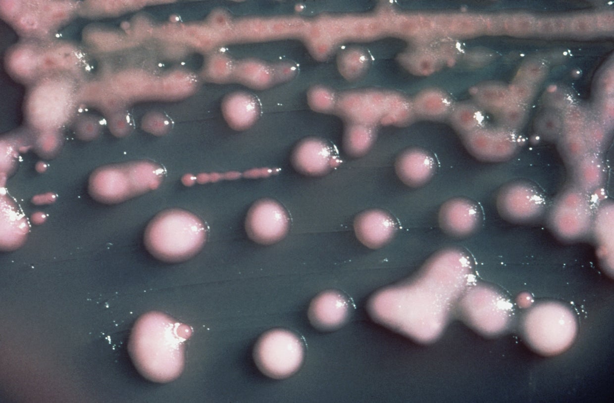 15 superbugs and other scary diseases