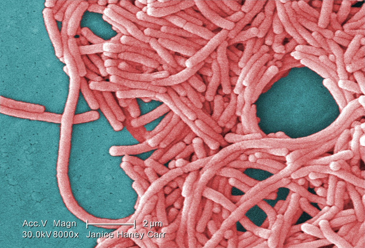15 superbugs and other scary diseases