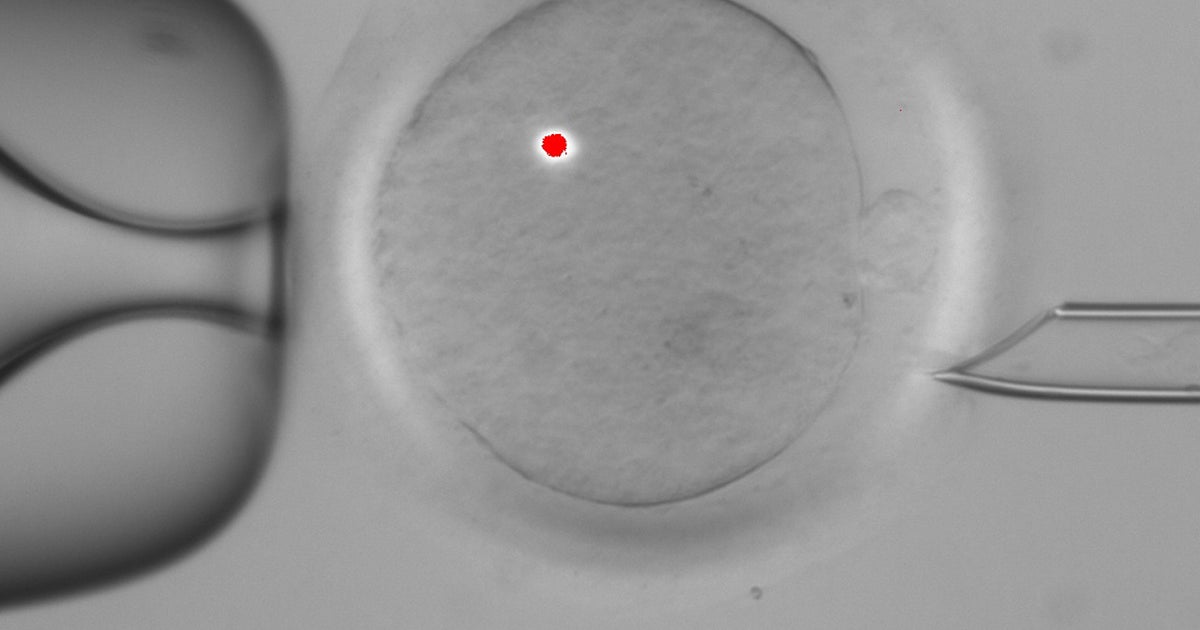 3-person DNA babies: Britain's Newcastle University gets first license ...