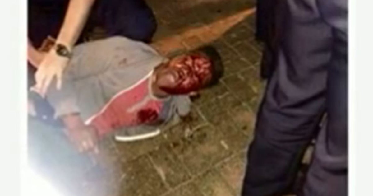 Martese Johnson, University of Virginia student in bloody arrest, makes ...