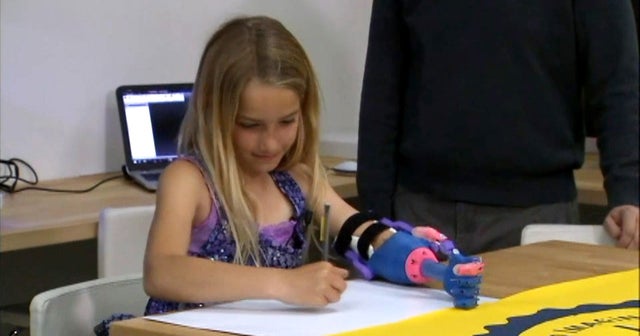 High-tech, low-cost robotic hand changes girl's life - CBS News