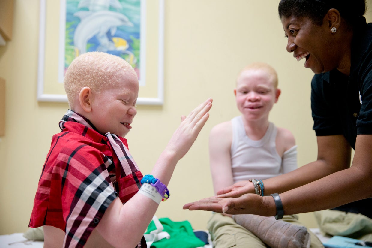 New limbs, new hope for Africa's hunted albino children
