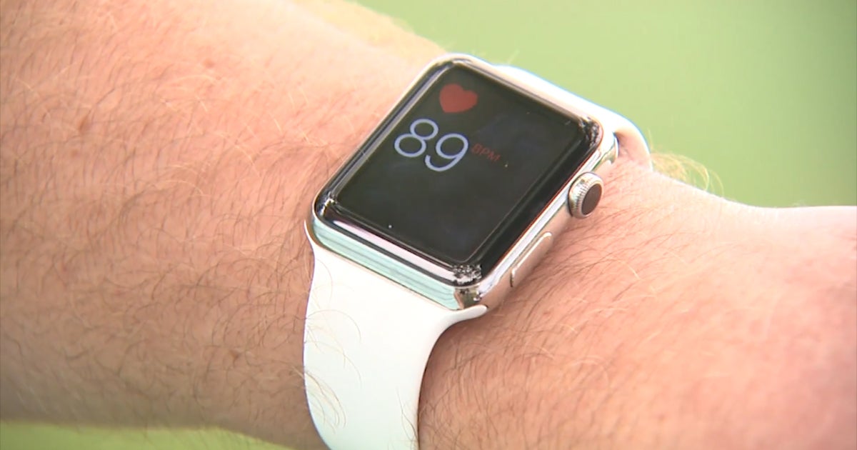 Apple Watch helps save teen athlete's life - CBS News