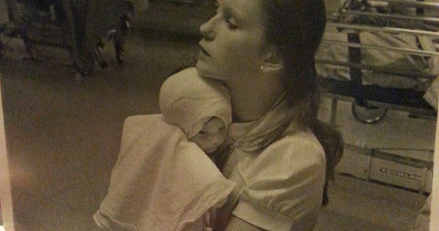 Woman burned as a baby reunites with nurse who cared for her - CBS News