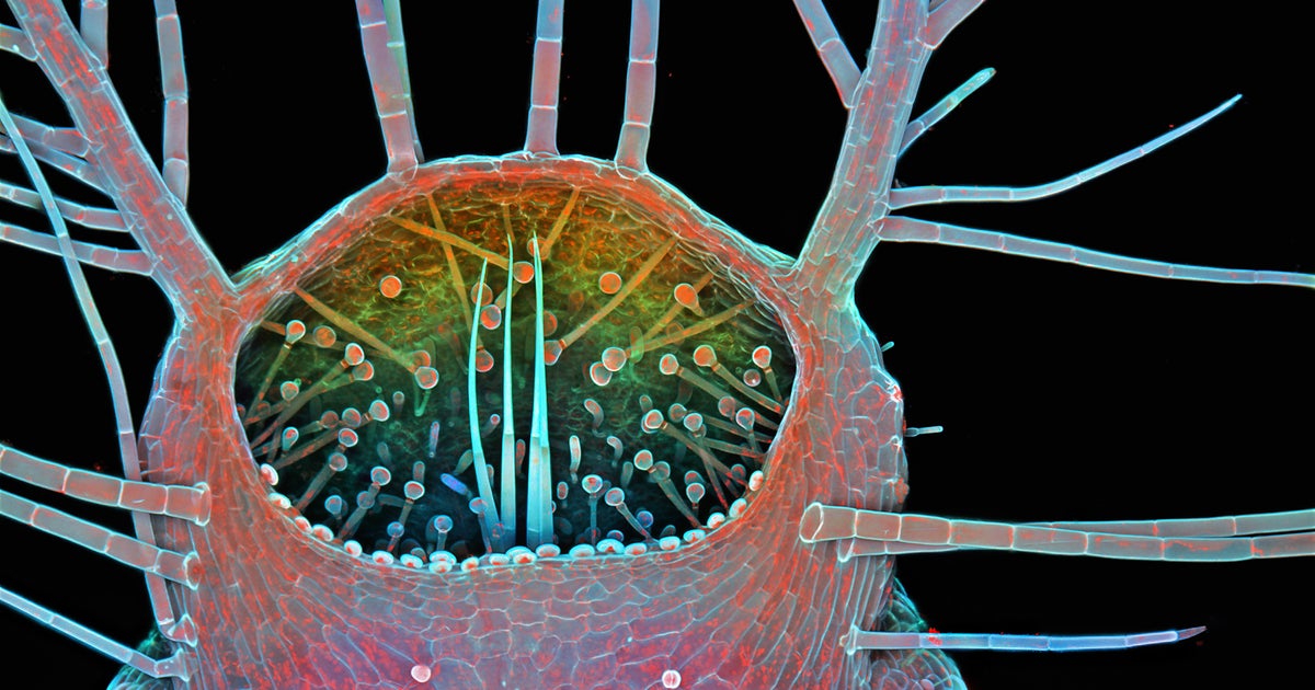 Microscopic beauty: Winning images from the Nikon Small World 2015 ...