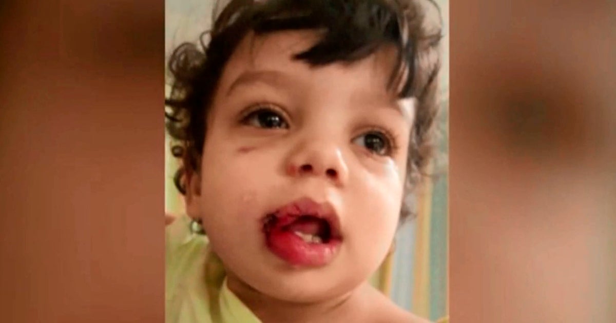 Family Demands Justice After Toddler Shot In Face In New Jersey CBS News family-demands-justice-after-toddler-shot-in-face-in-new-jersey-cbs-news