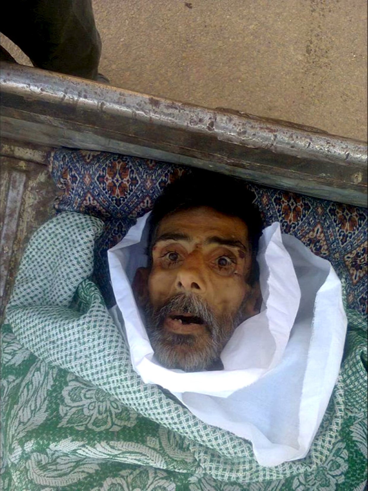 "Starvation as a weapon of war" in Syria