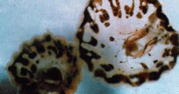 "Sea lice" stinging swimmers off Florida Panhandle beach - CBS News