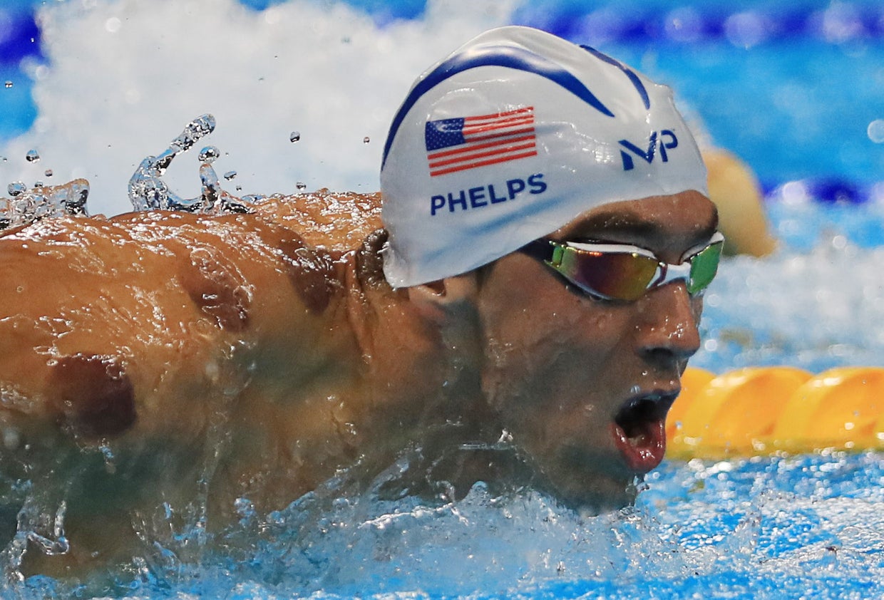 Why is "cupping" attracting Olympic athletes like Michael Phelps? - CBS ...