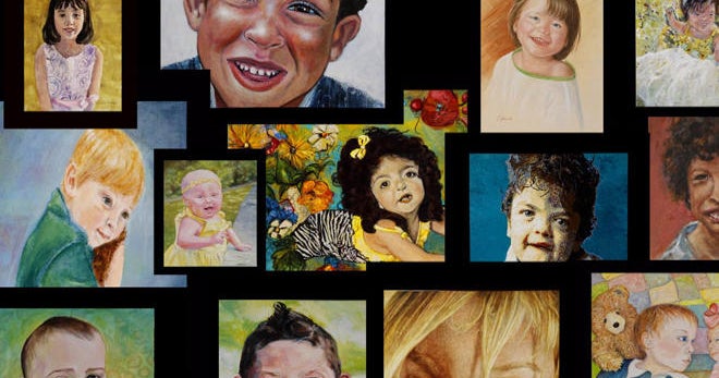 Putting a face on rare, incurable diseases - CBS News