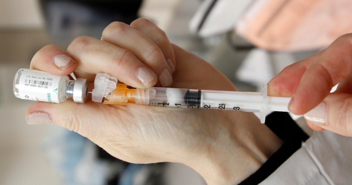 Chickenpox cases drop drastically since 2-dose vaccine began - CBS News