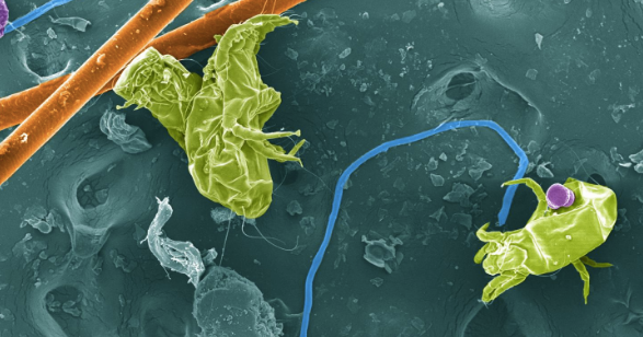 DNA in dust reveals truth about bugs lurking in our homes - CBS News