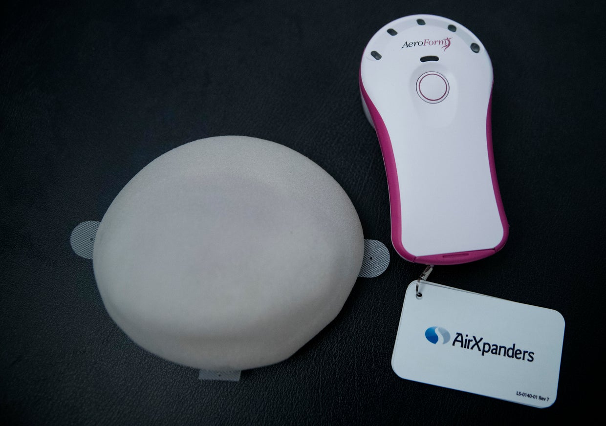 Do-it-yourself breast reconstruction device gives breast cancer ...