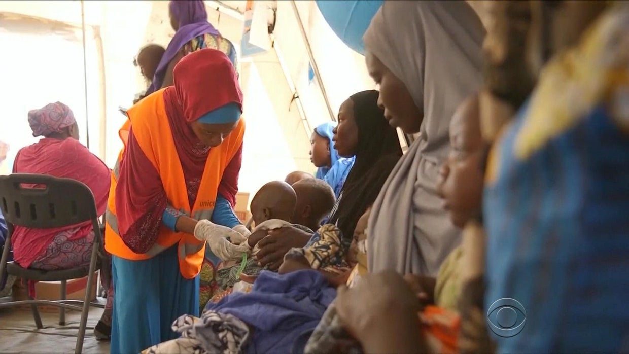 20 million people in 4 countries on the brink of famine - CBS News