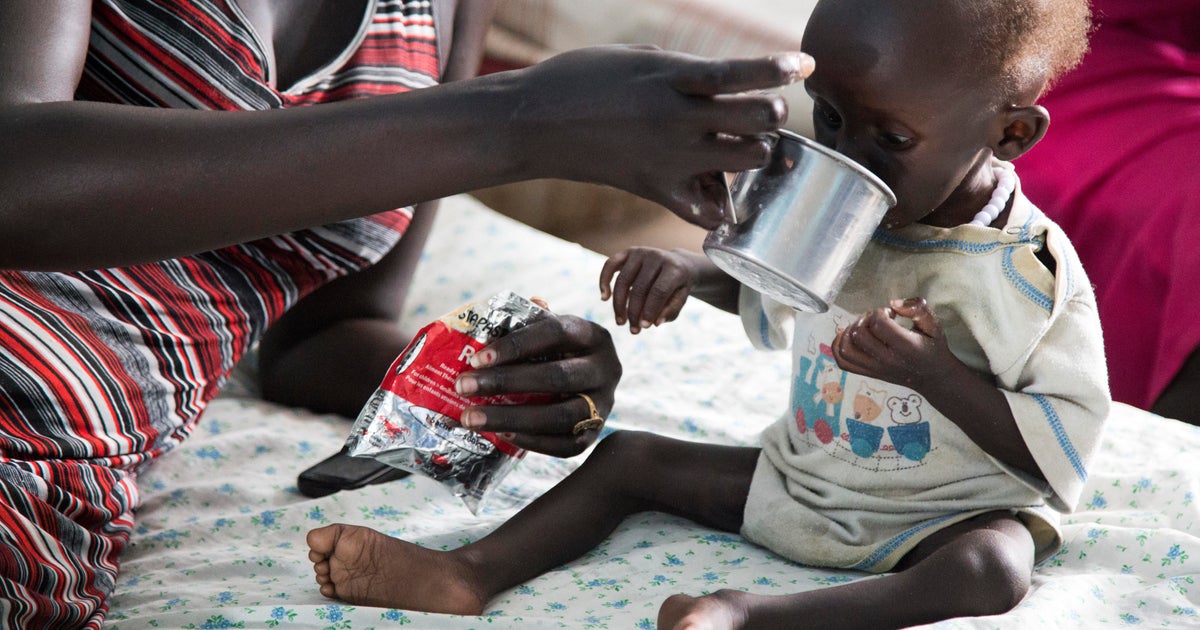 Fighting famine in war-torn South Sudan - CBS News
