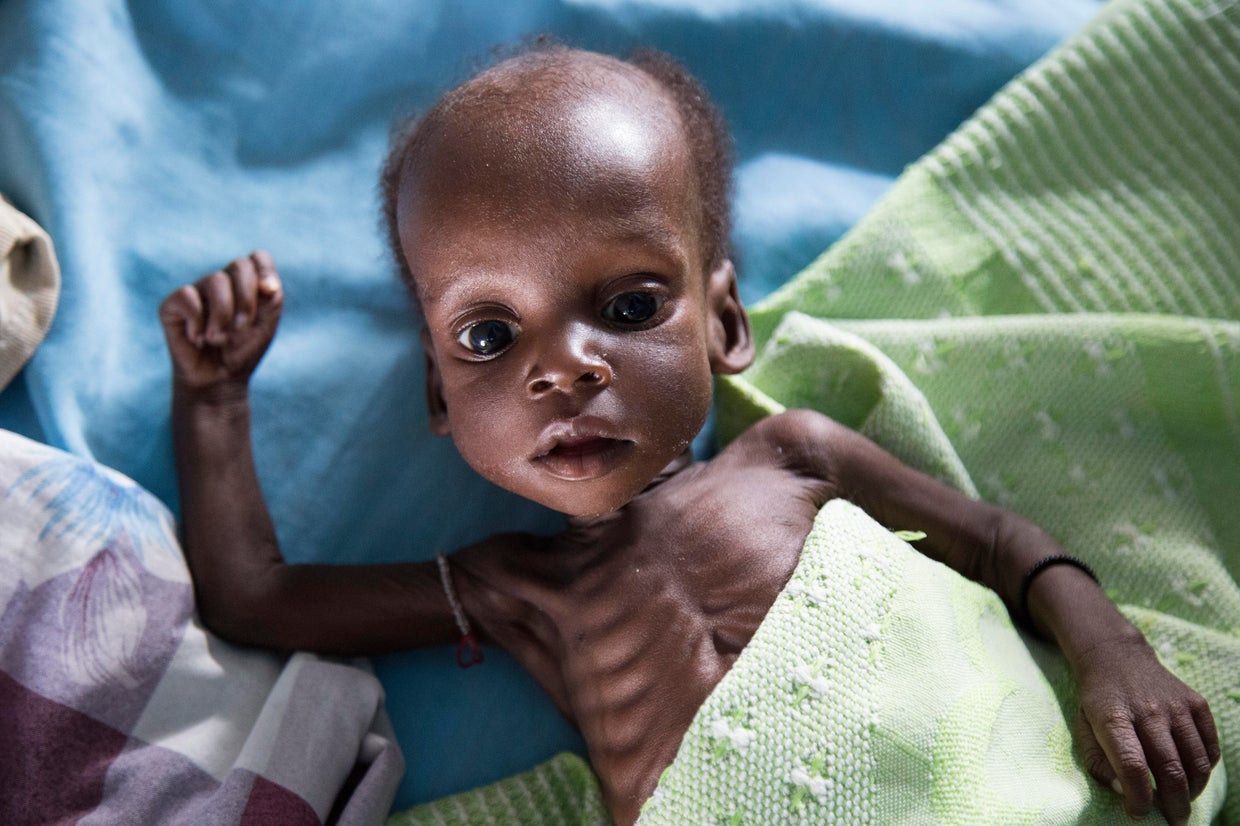 Starving in South Sudan