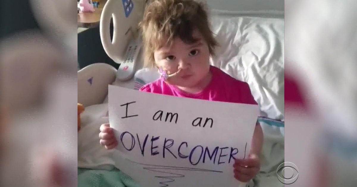 Leah Caroll the Overcomer: 4-year-old inspires millions amid severe ...