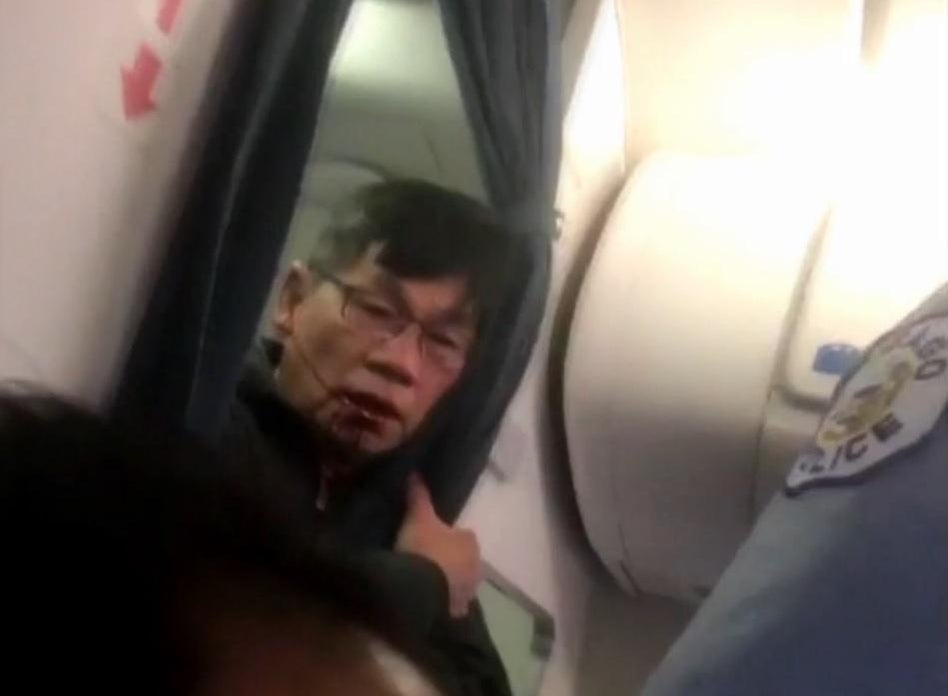 United Airlines passenger suffered broken nose, concussion - CBS News