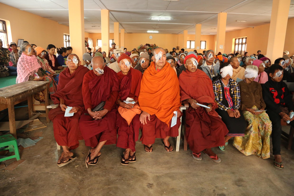 Restoring eyesight with a simple, inexpensive surgery - CBS News