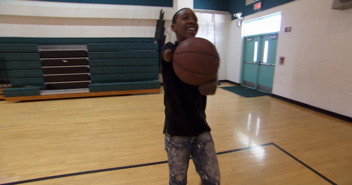 Teen who lost his hands makes 3-point shots on the basketball court ...