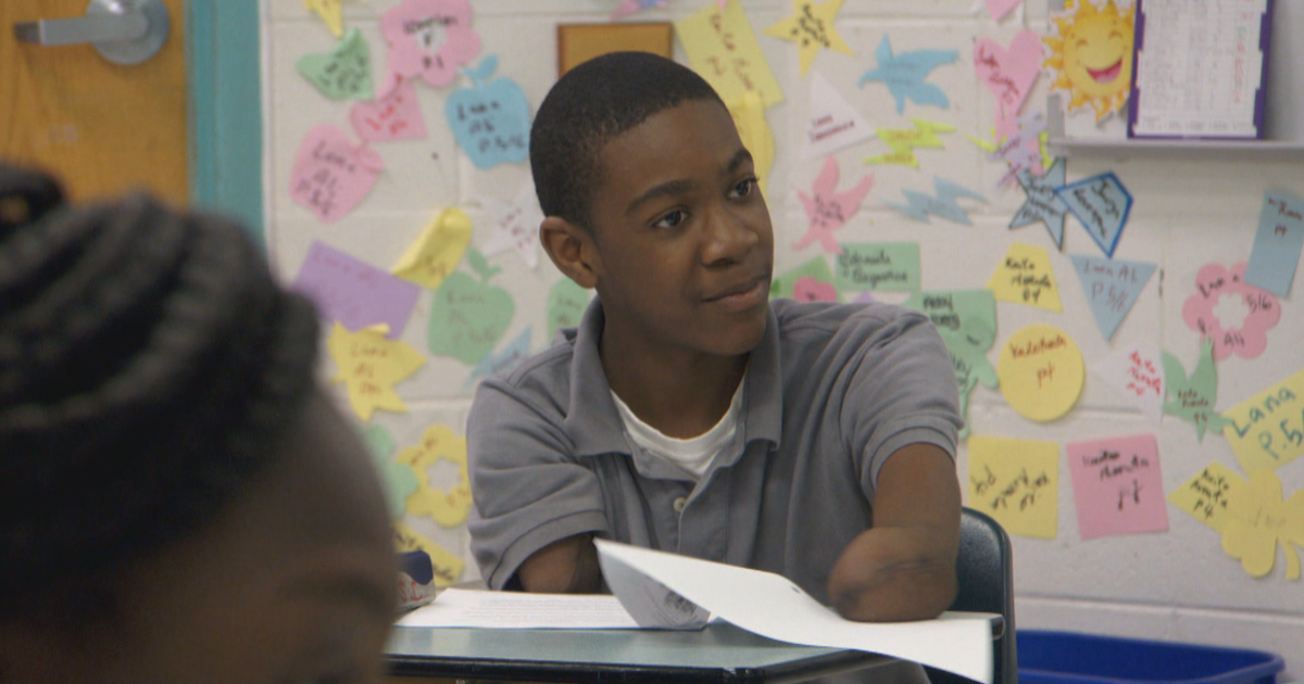 Teen who lost his hands becomes unlikely basketball hero - CBS News