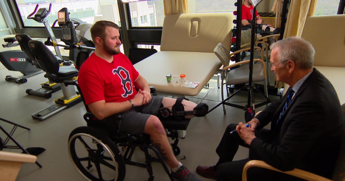 Afghanistan vet injured by land mine undergoes experimental amputation ...