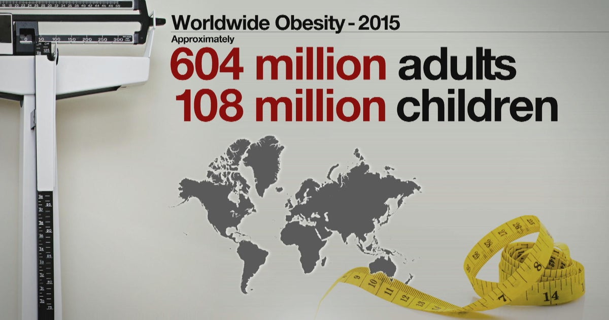 1 in 10 people on Earth is obese, report finds - CBS News