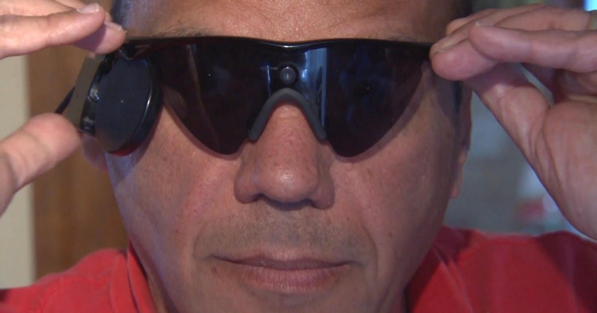 After 20 years of darkness, bionic eye helps blind man see - CBS News