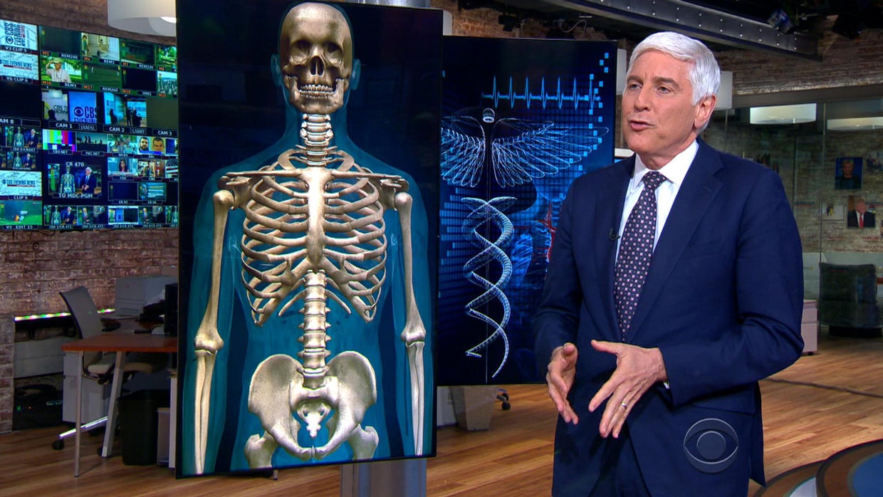 Details on the dangers of Rep. Steve Scalise's injuries - CBS News